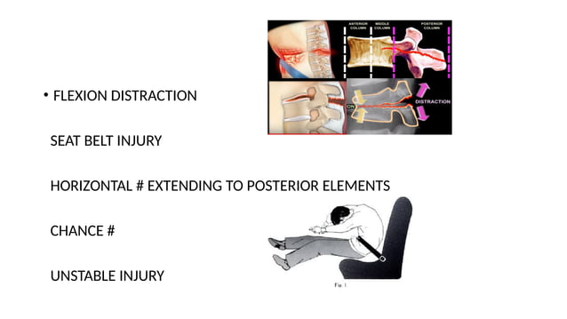 SPINAL INJURIES Anatomy three column concept log rolling investigation ...