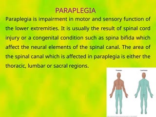 SPINAL INJURIES.pptx yxitsizz8tzzsyxxoxt | PPTX