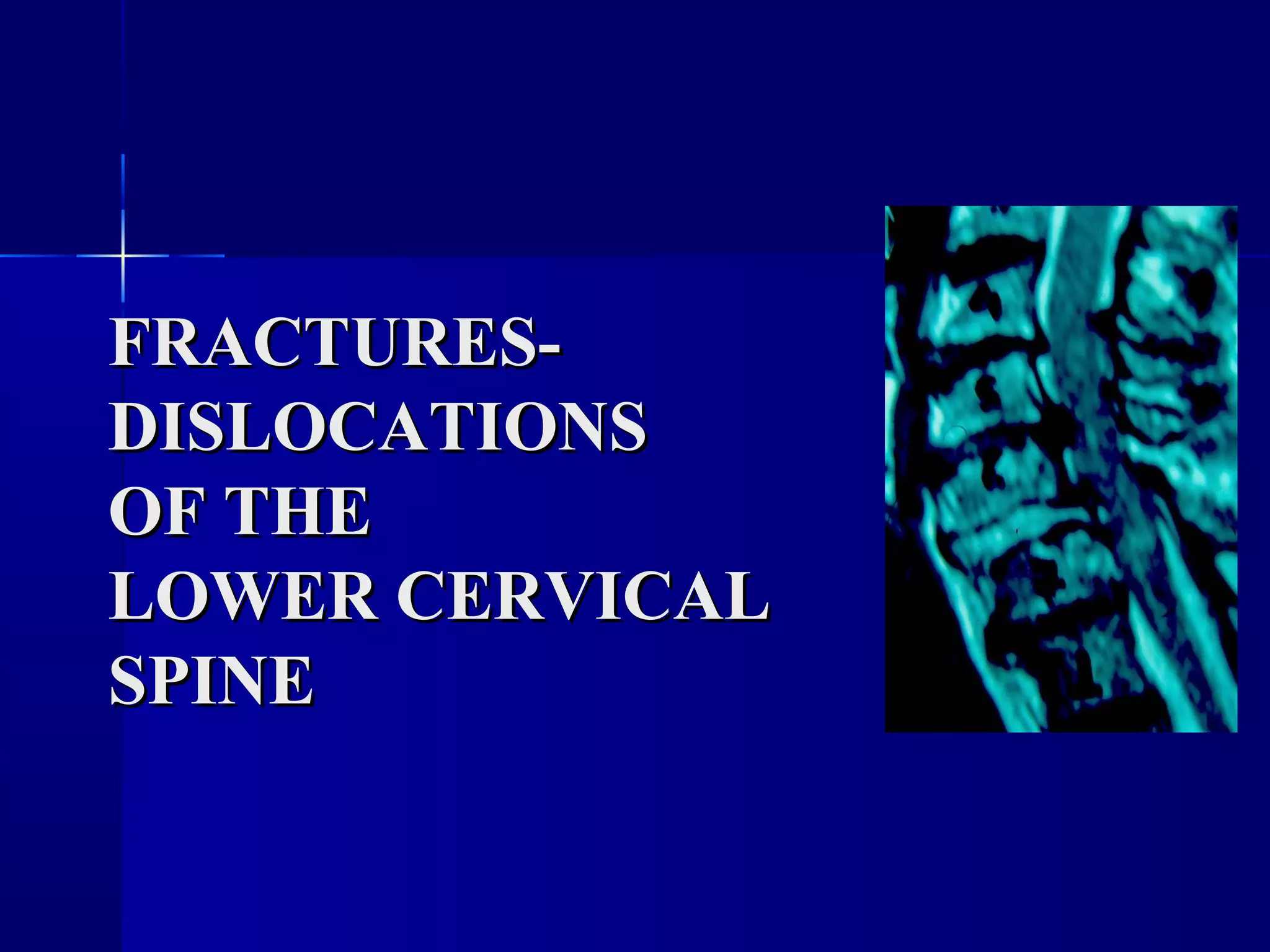 Spinal injuries | PPT