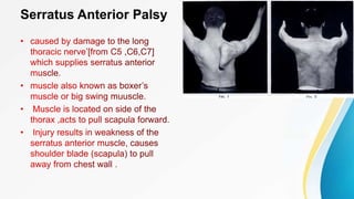 this is a description of spinal injuries in sports players and this ...