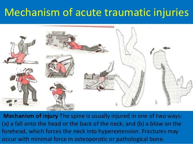 Spinal injuries monday 3 10 20014