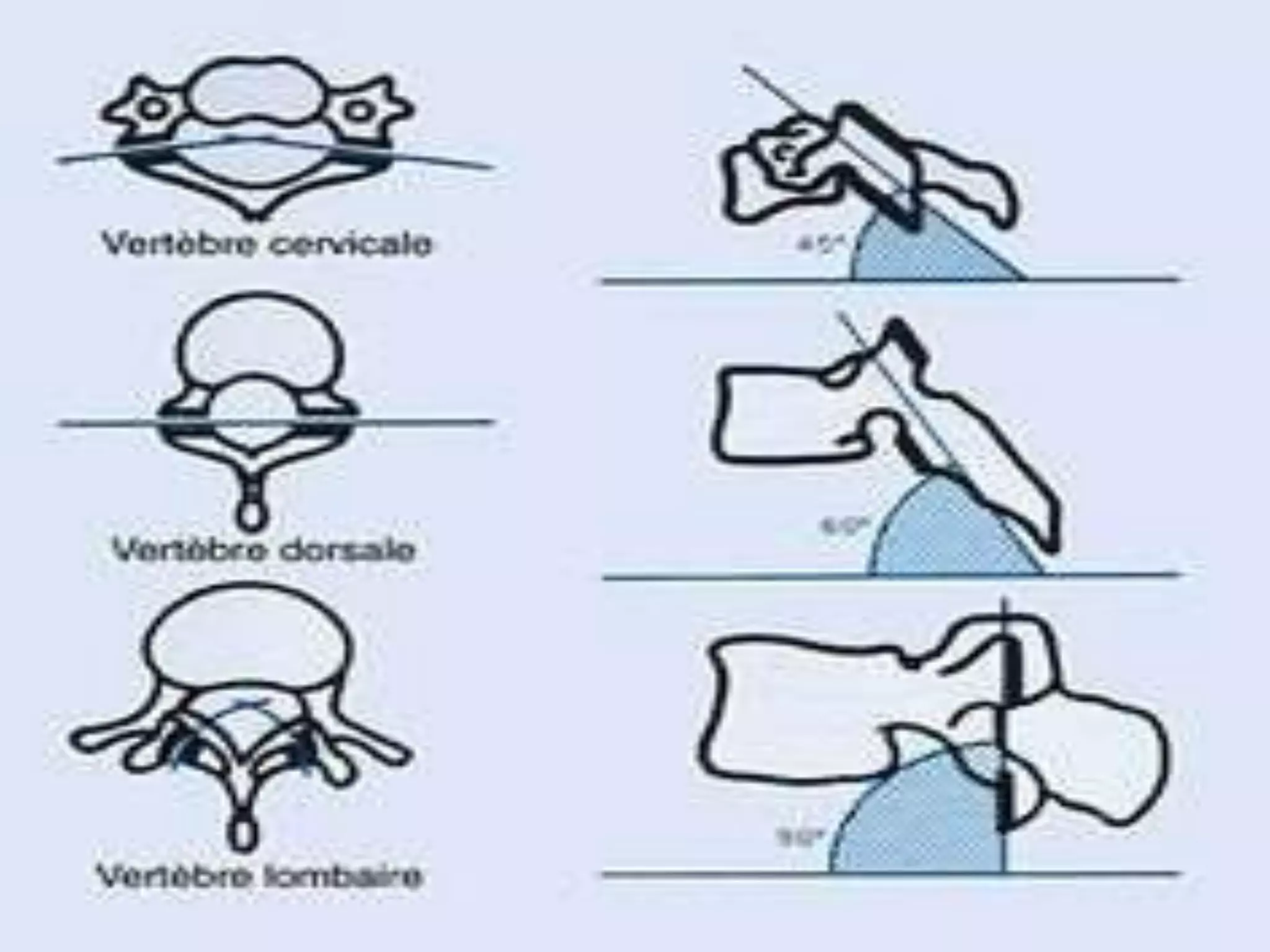 Spinal fractures (injury) | PPTX