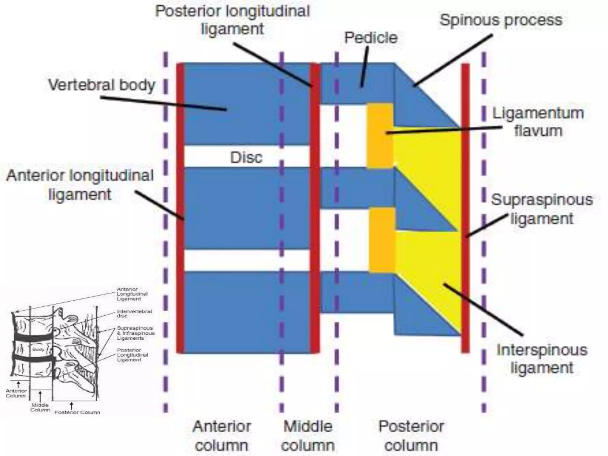 Spinal fractures (injury) | PPTX