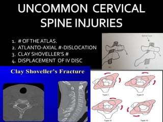 Spinal fractures (injury) | PPTX