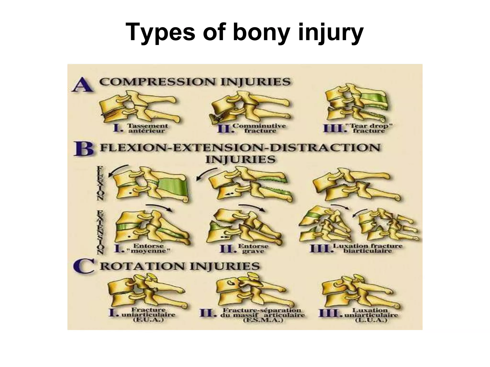 Spinal Injury Trauma.pptx