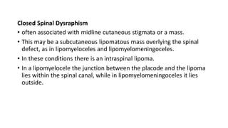 Spinal malformations | PPTX