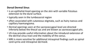 Spinal malformations | PPTX