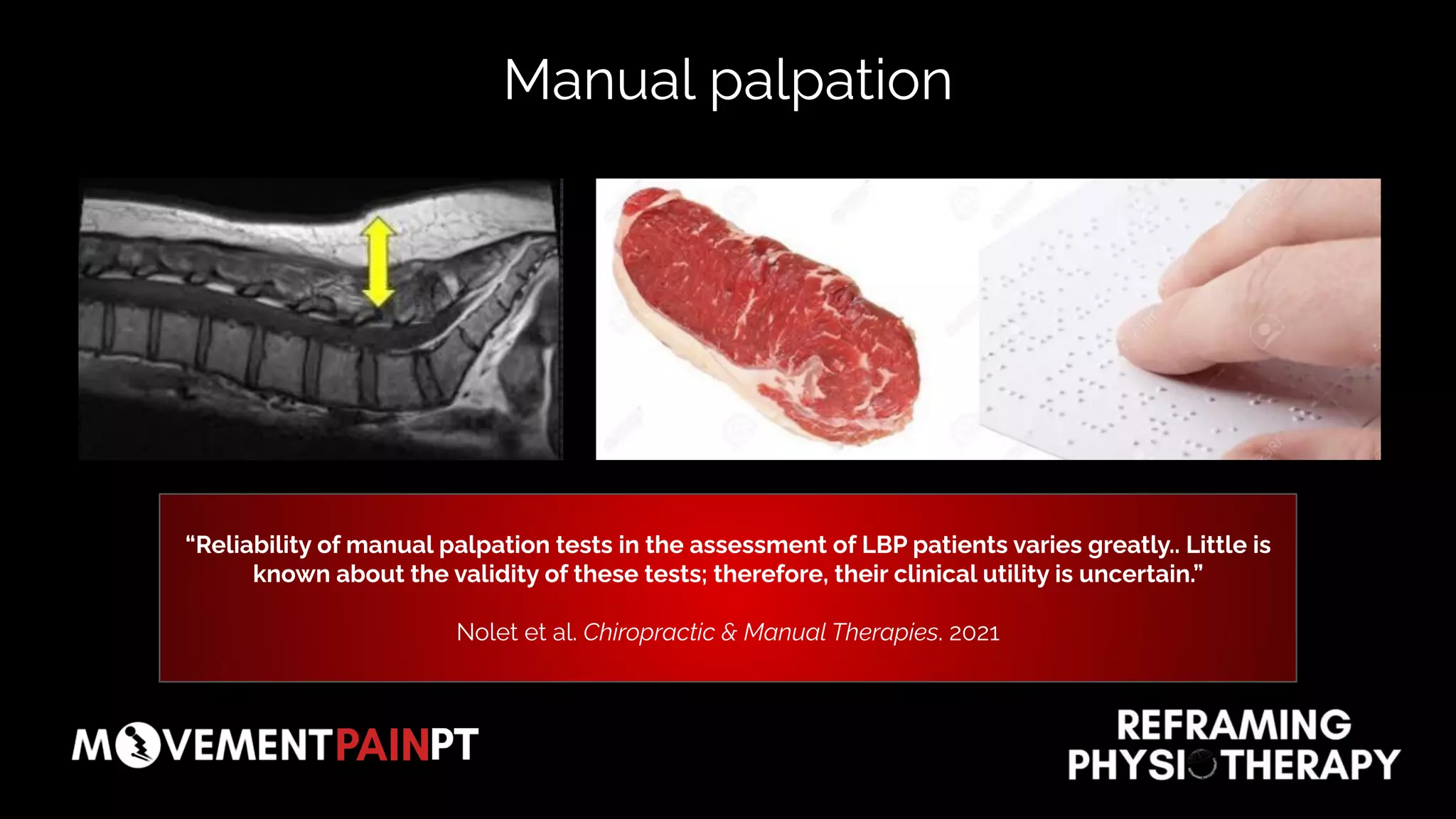 Spinal Manipulation for Low Back Pain.pdf