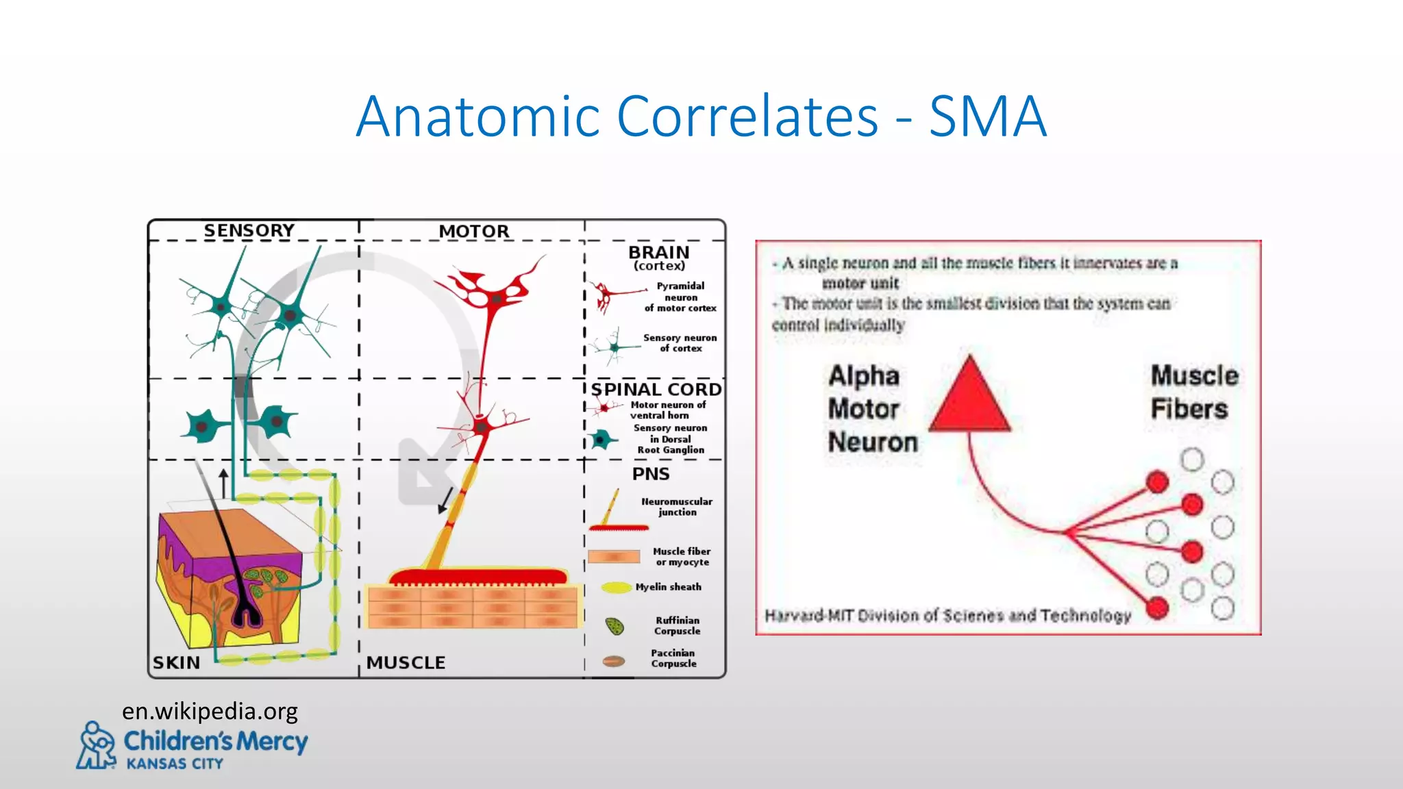 Spinal Muscular Atrophy: Diagnosis and Global Management Considerations ...
