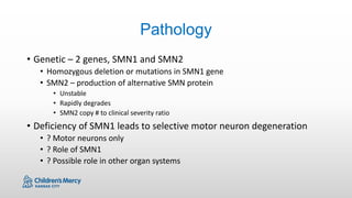 Spinal Muscular Atrophy: Diagnosis and Global Management Considerations ...