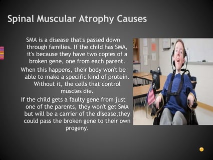 Spinal Muscular Atrophy.pptx