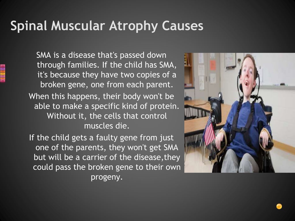 Spinal Muscular Atrophy.pptx