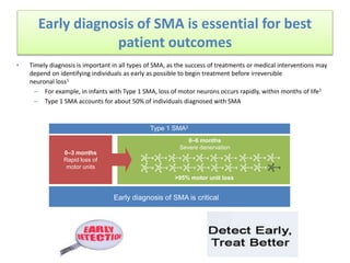 Spinal muscular atrophy (sma) | PPTX