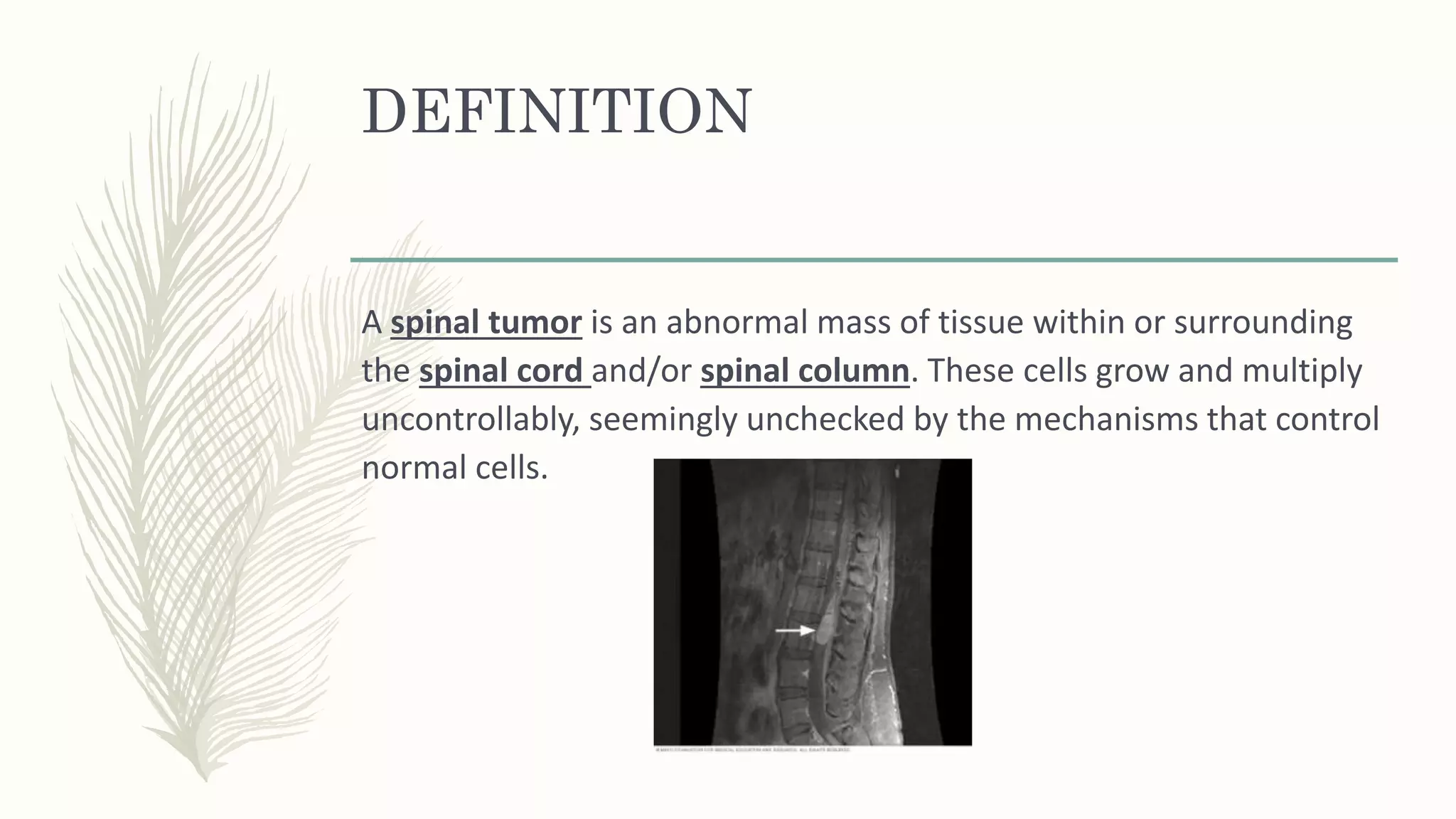 Spinal neoplasm | PPTX