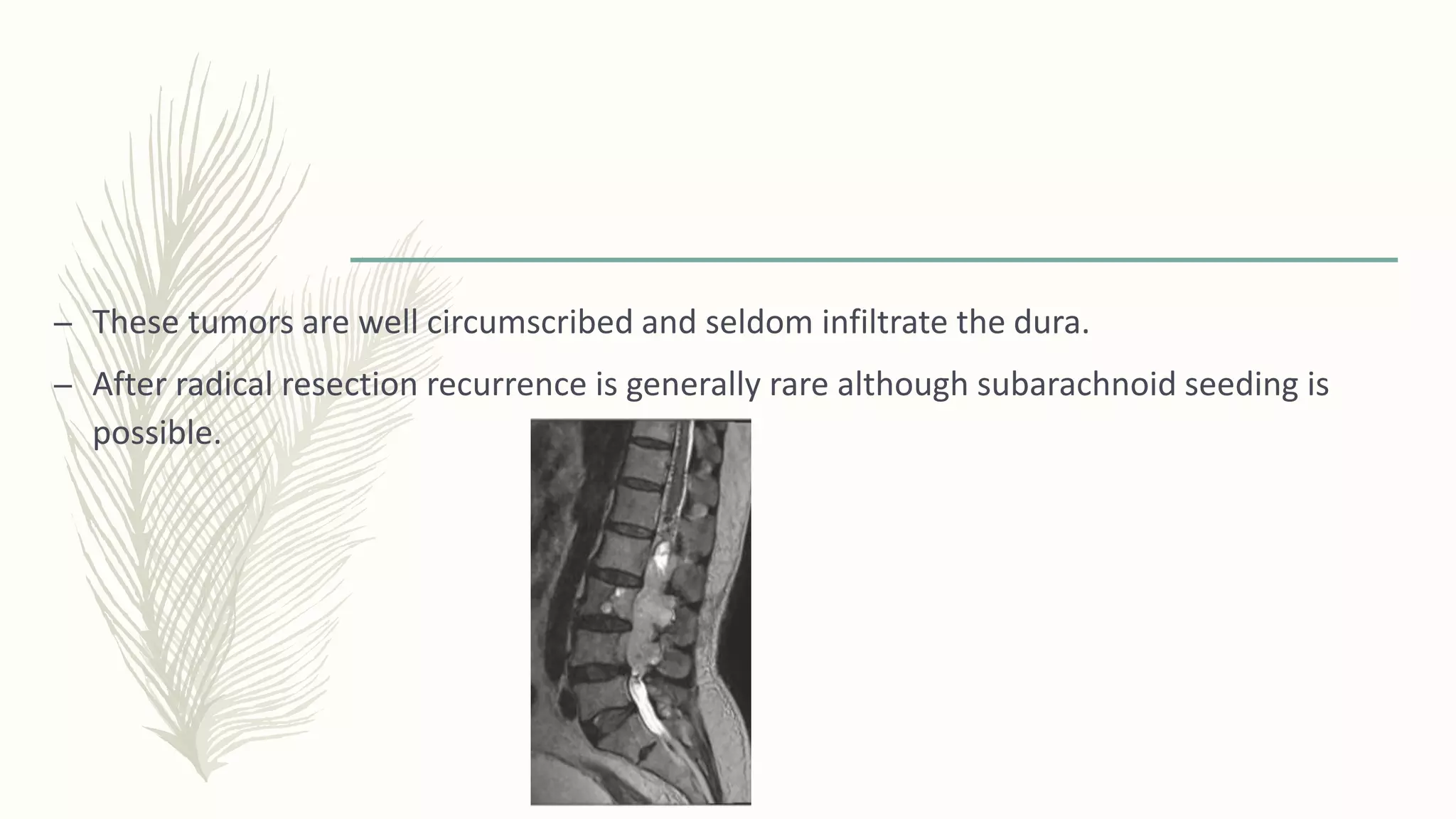 Spinal neoplasm | PPTX
