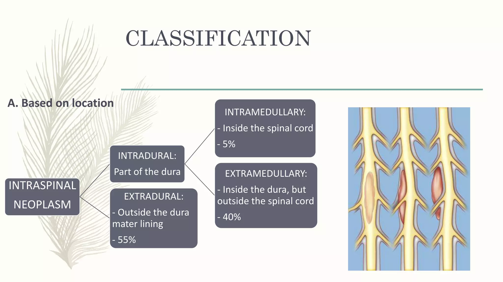 Spinal neoplasm | PPTX