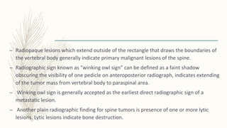 Spinal neoplasm | PPTX