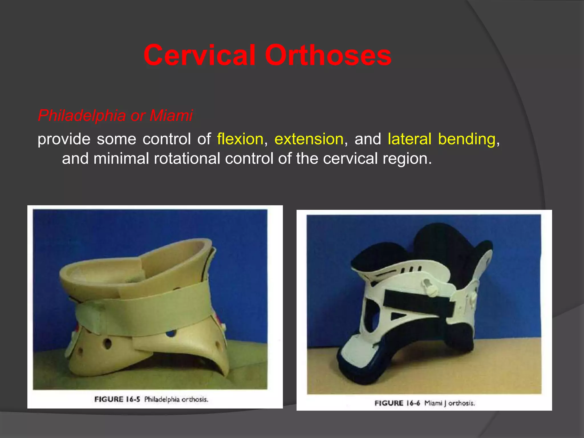 Spinal orthoses | PPTX