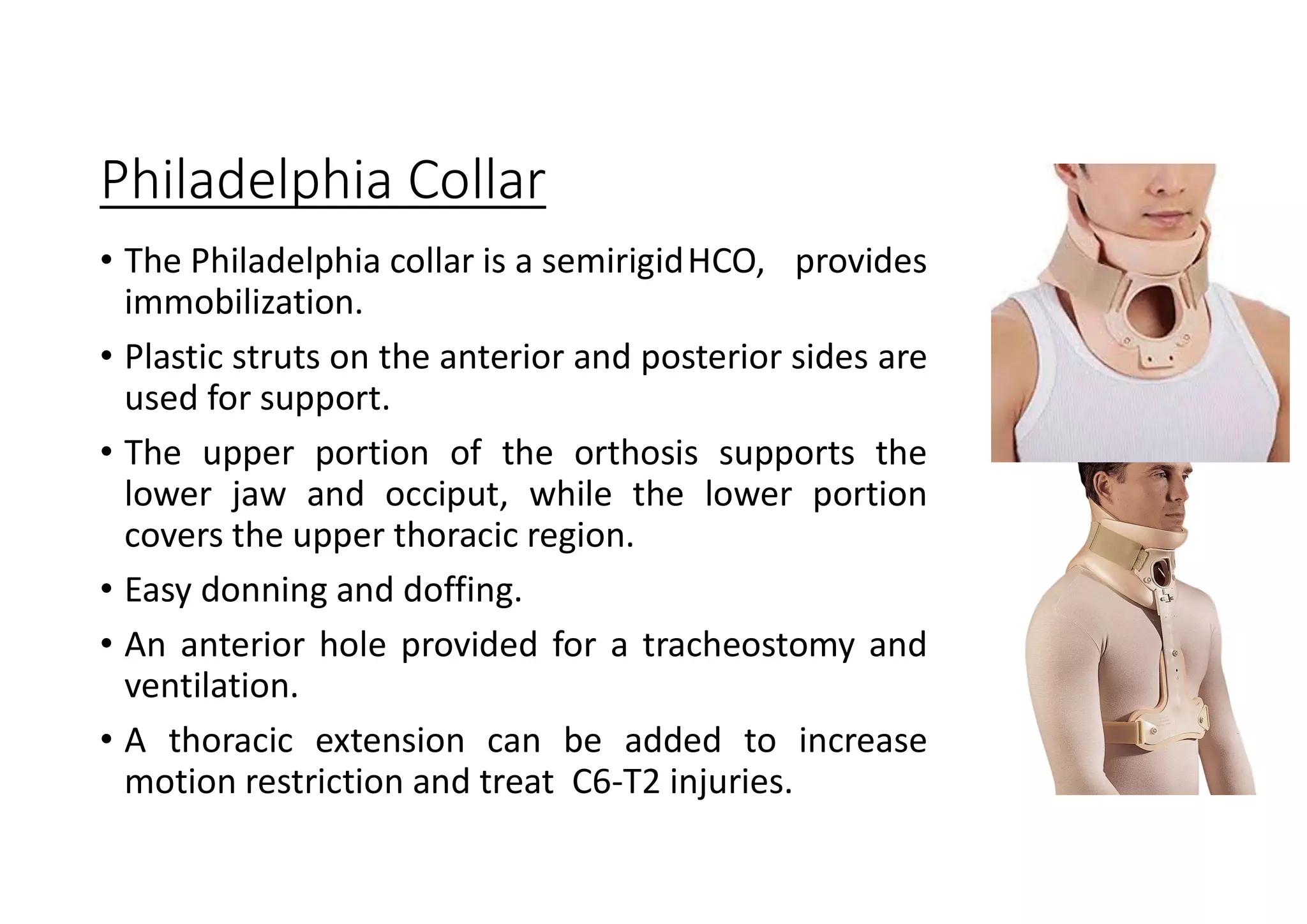 Spinal orthoses | PDF