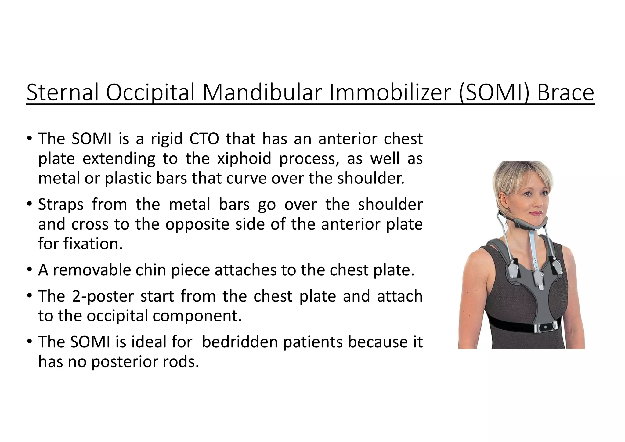 Spinal orthoses | PDF