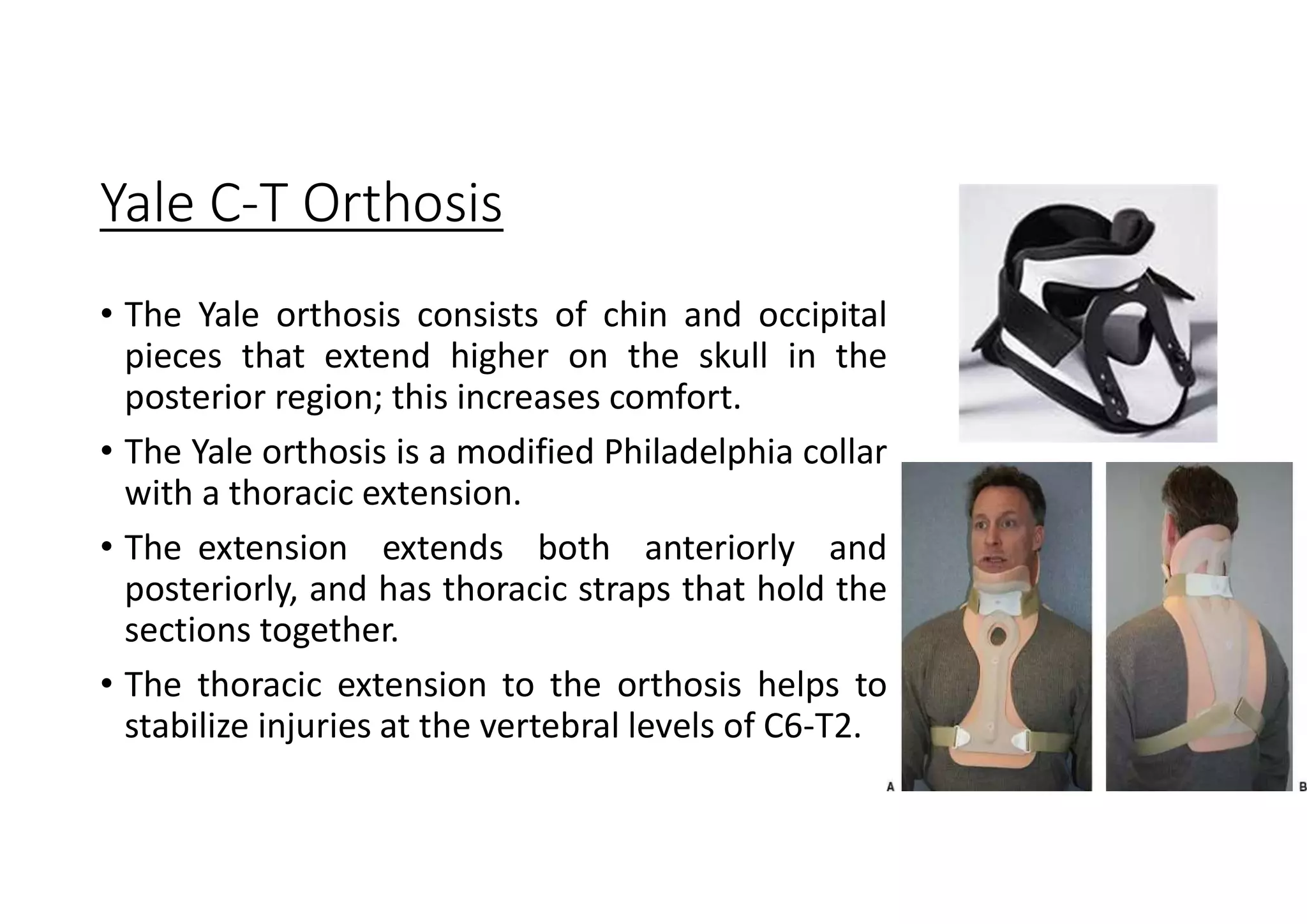 Spinal orthoses | PDF
