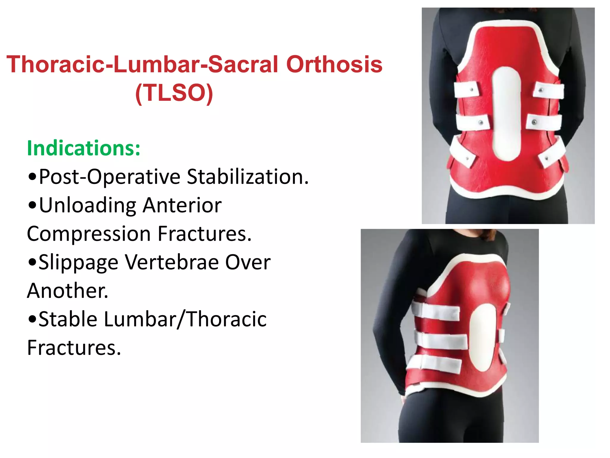 Spinal orthosis | PPTX