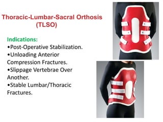 Spinal orthosis | PPTX