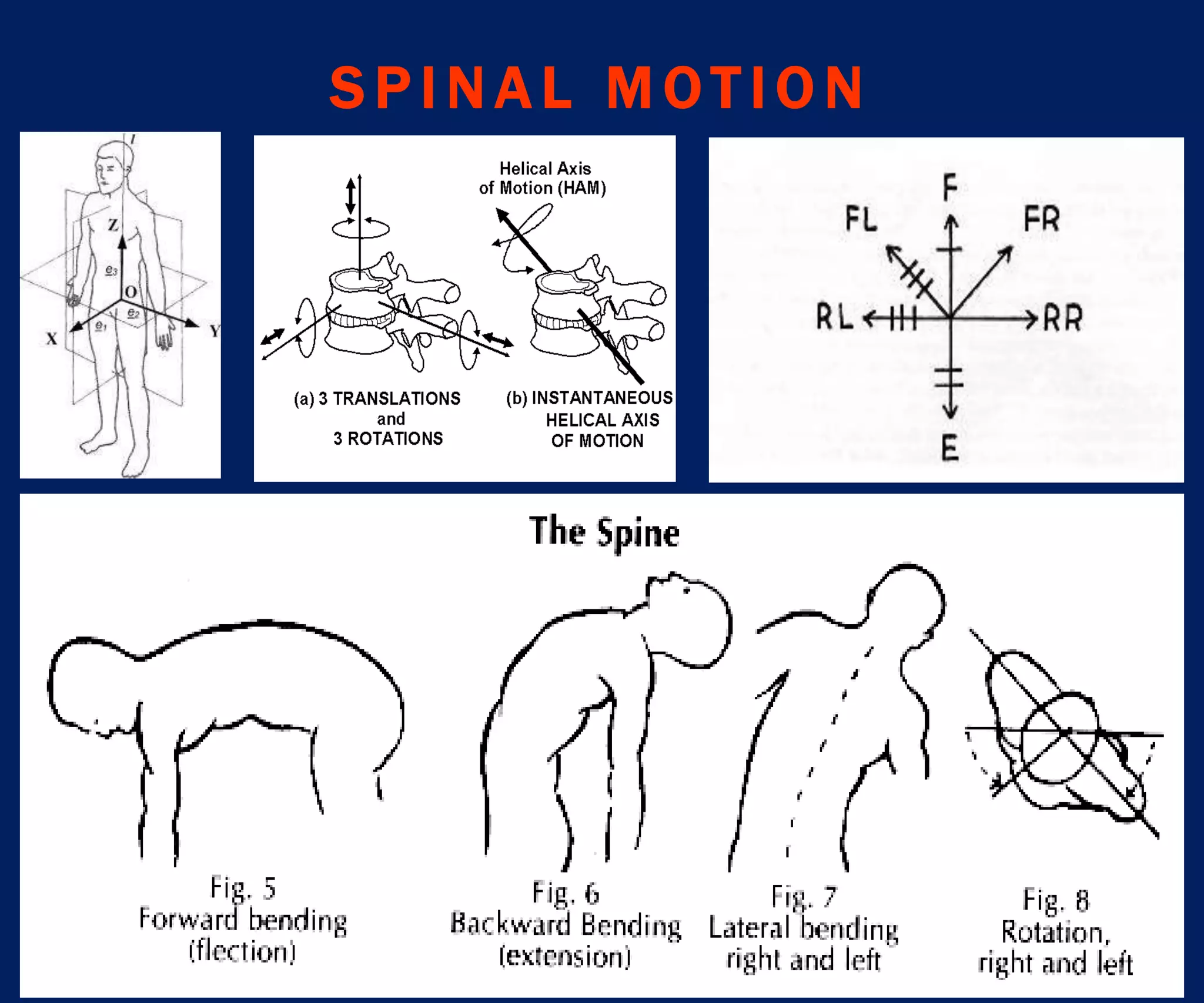 Spinal orthosis dr.aliaa | PPTX