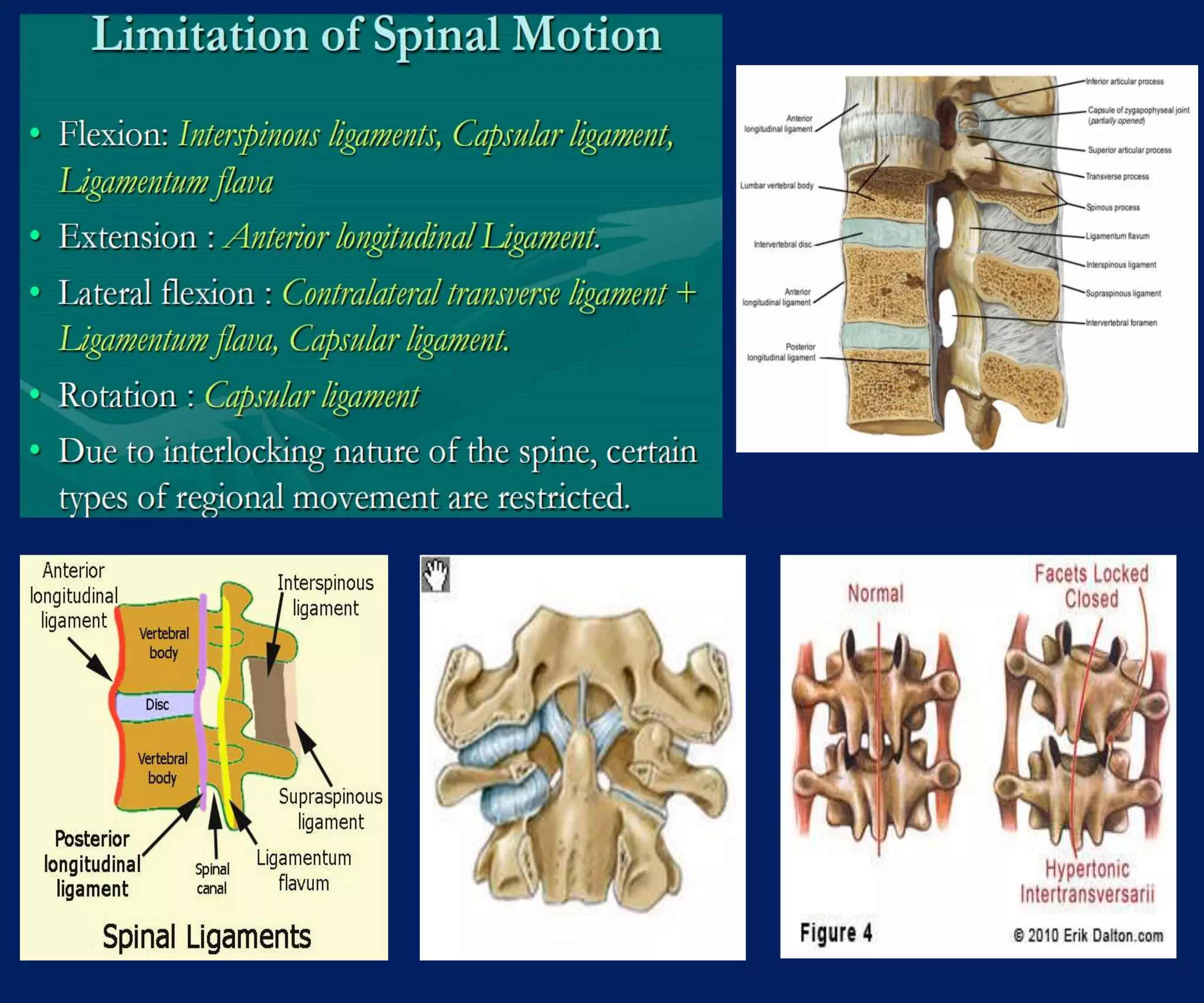 Spinal orthosis dr.aliaa | PPTX