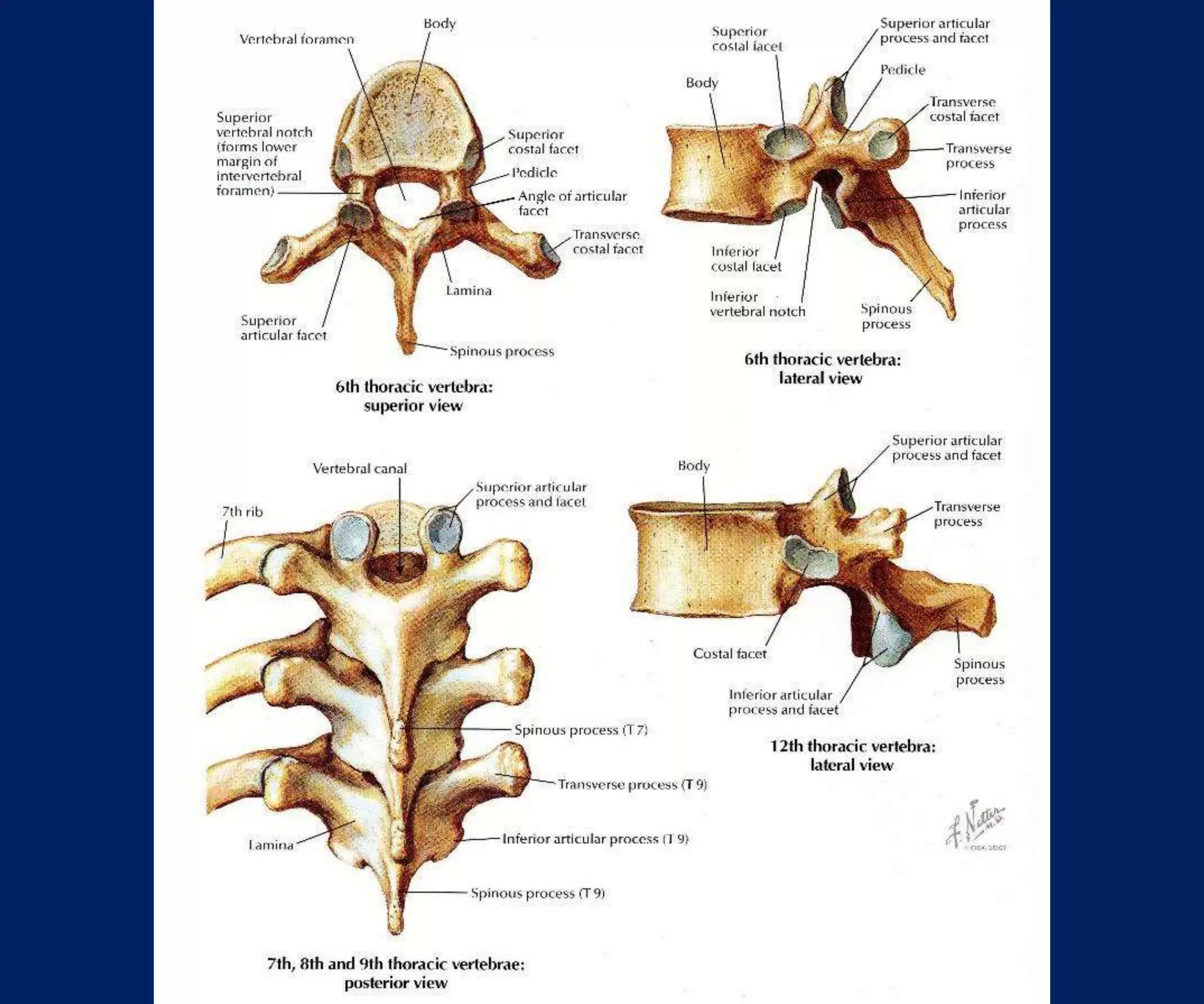 Spinal orthosis dr.aliaa | PPTX