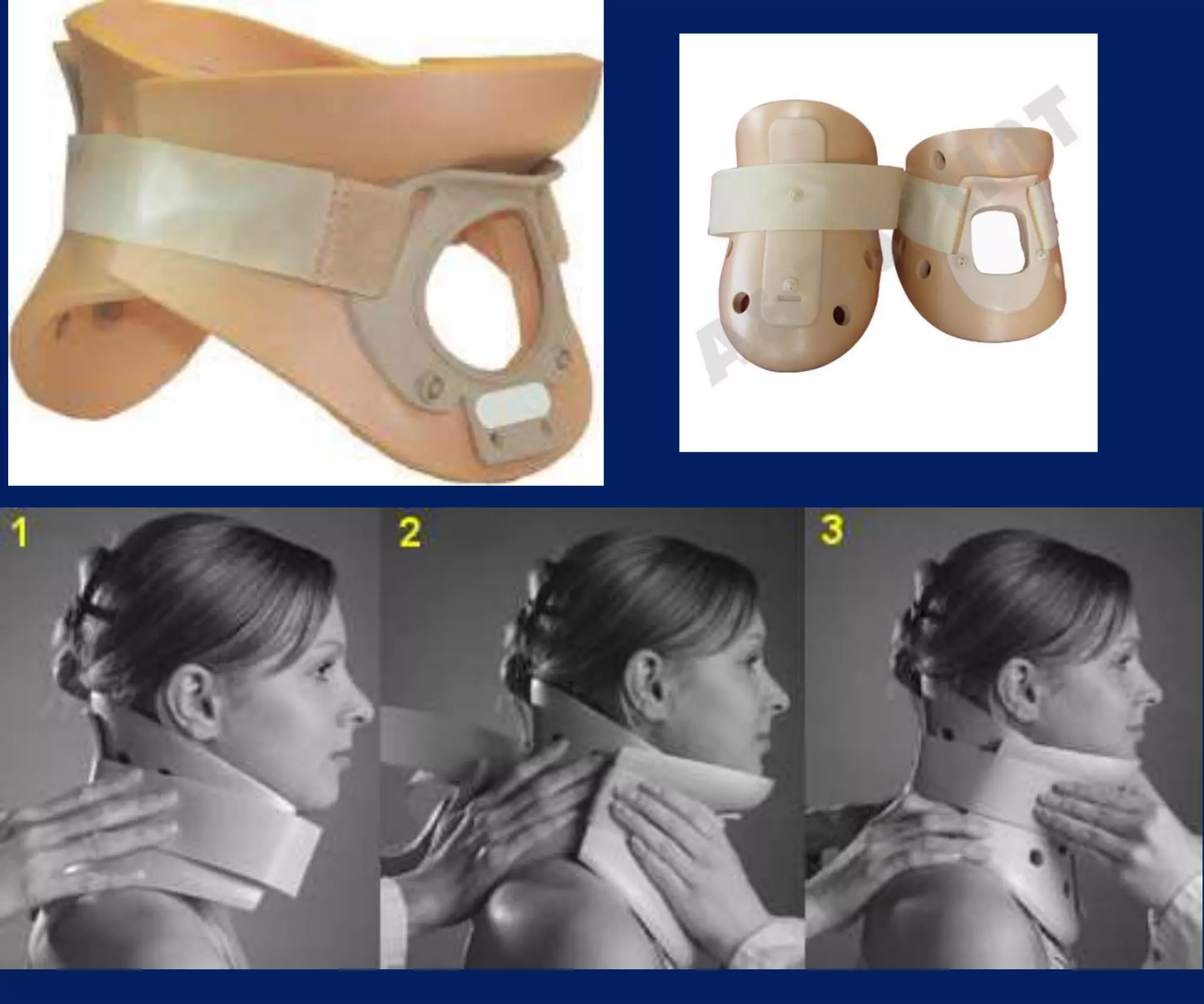 Spinal orthosis dr.aliaa | PPTX