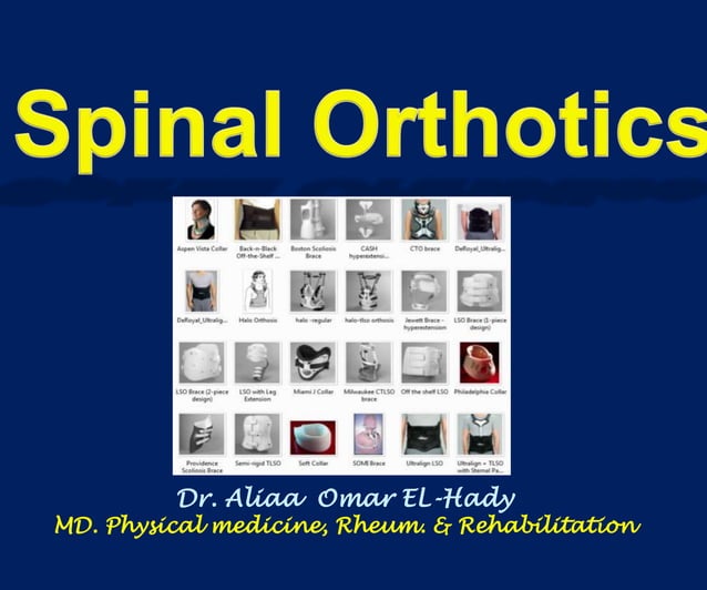 Spinal orthosis dr.aliaa | PPTX