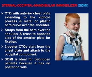Spinal orthosis dr.aliaa | PPTX