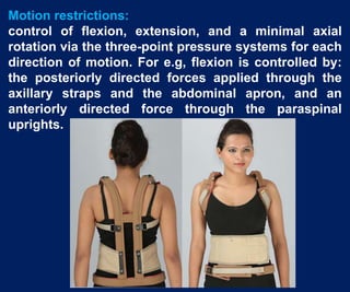 Spinal orthosis dr.aliaa | PPTX