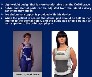 Spinal orthosis dr.aliaa | PPTX