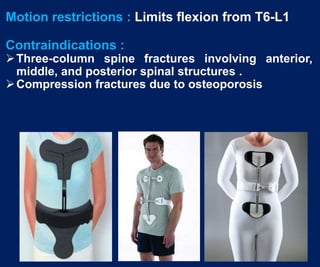 Spinal orthosis dr.aliaa | PPTX