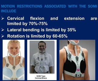 Four Poster Orthosis