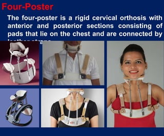 Spinal orthosis dr.aliaa | PPT