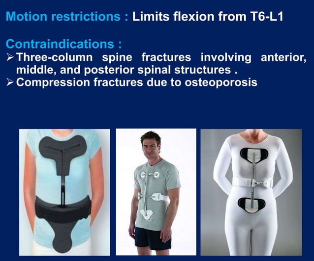 Spinal orthosis dr.aliaa | PPT