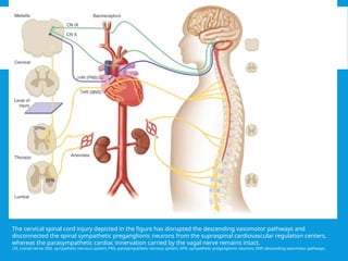 spinal shock vs neurogenic shock (1).pptx