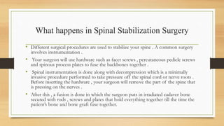 SPINAL STABILIZATION PPT | PPTX