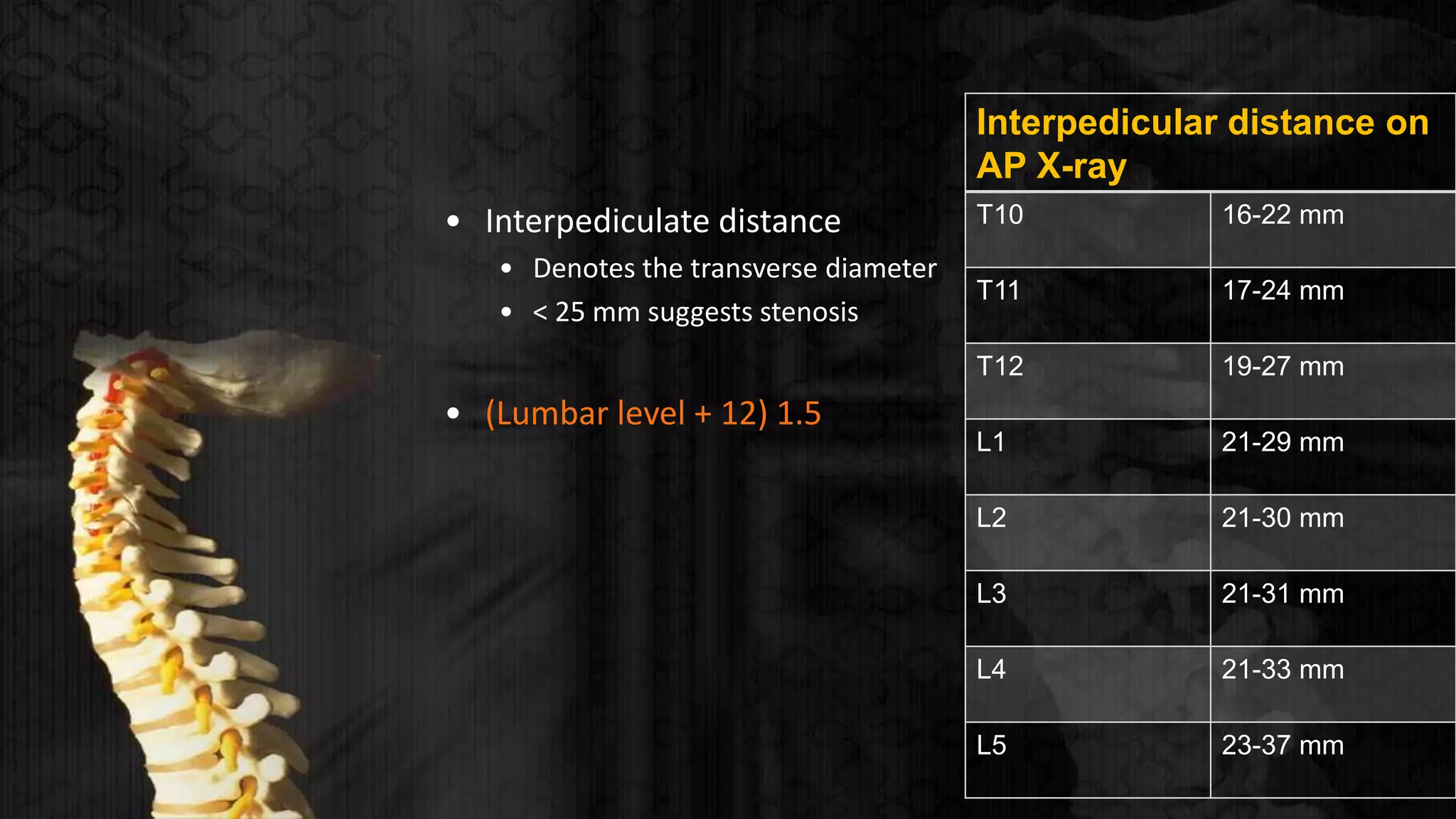 Spinal stenosis | PPTX