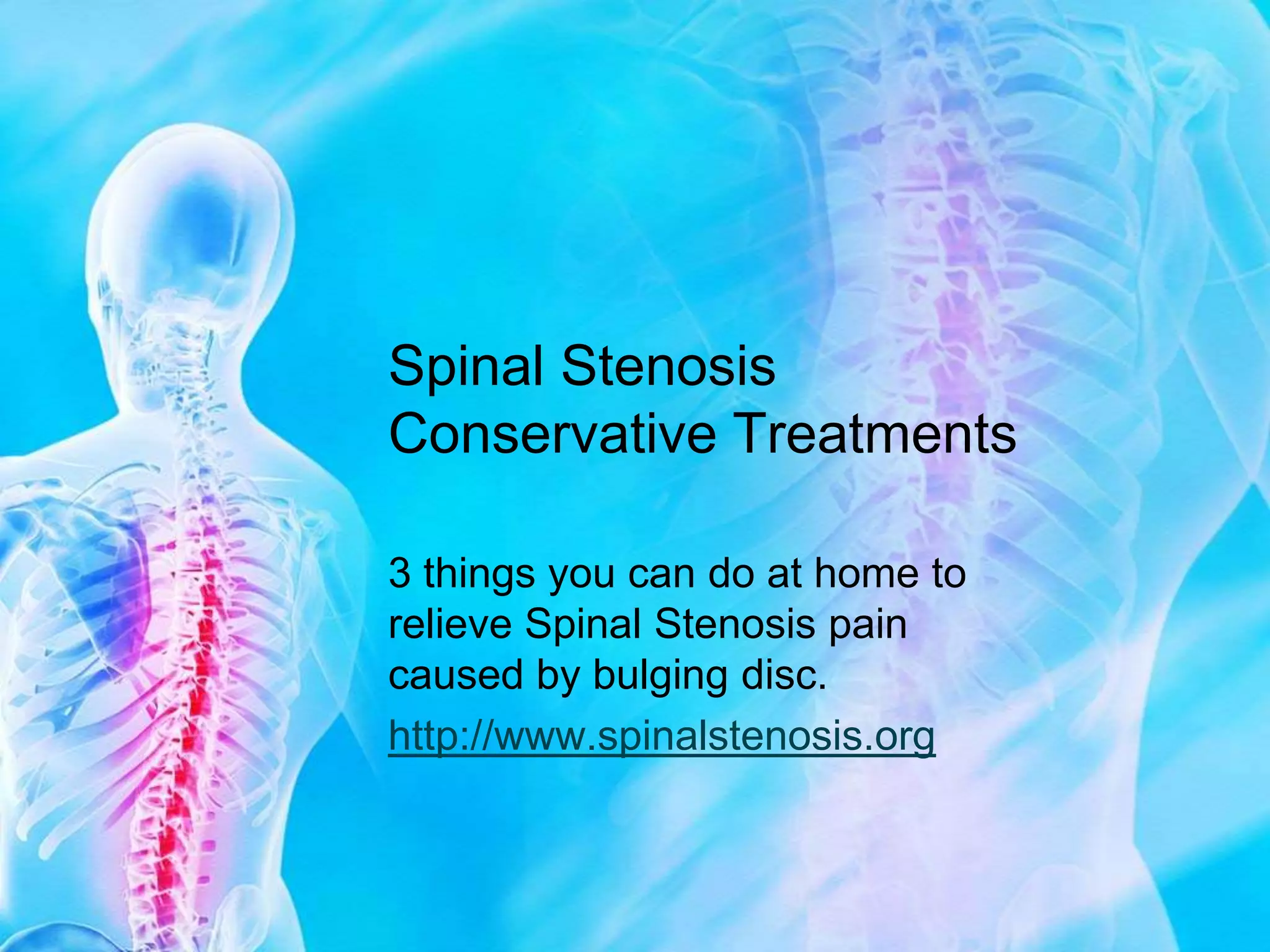 Spinal Stenosis Conservative Treatments | PPTX