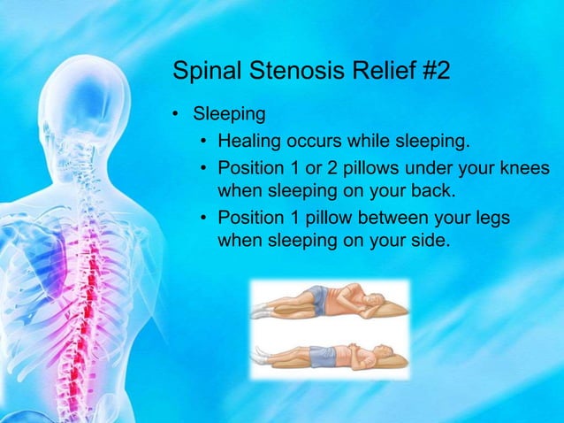 Spinal Stenosis Conservative Treatments | PPTX
