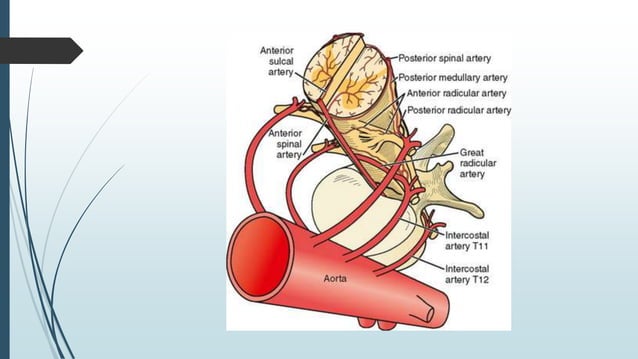 Spinal stroke | PPTX | Brain and Nervous System Disorders | Diseases ...
