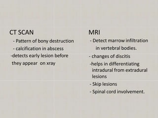 Spinal tb | PPTX