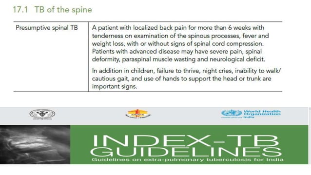 Spinal tb | PPT
