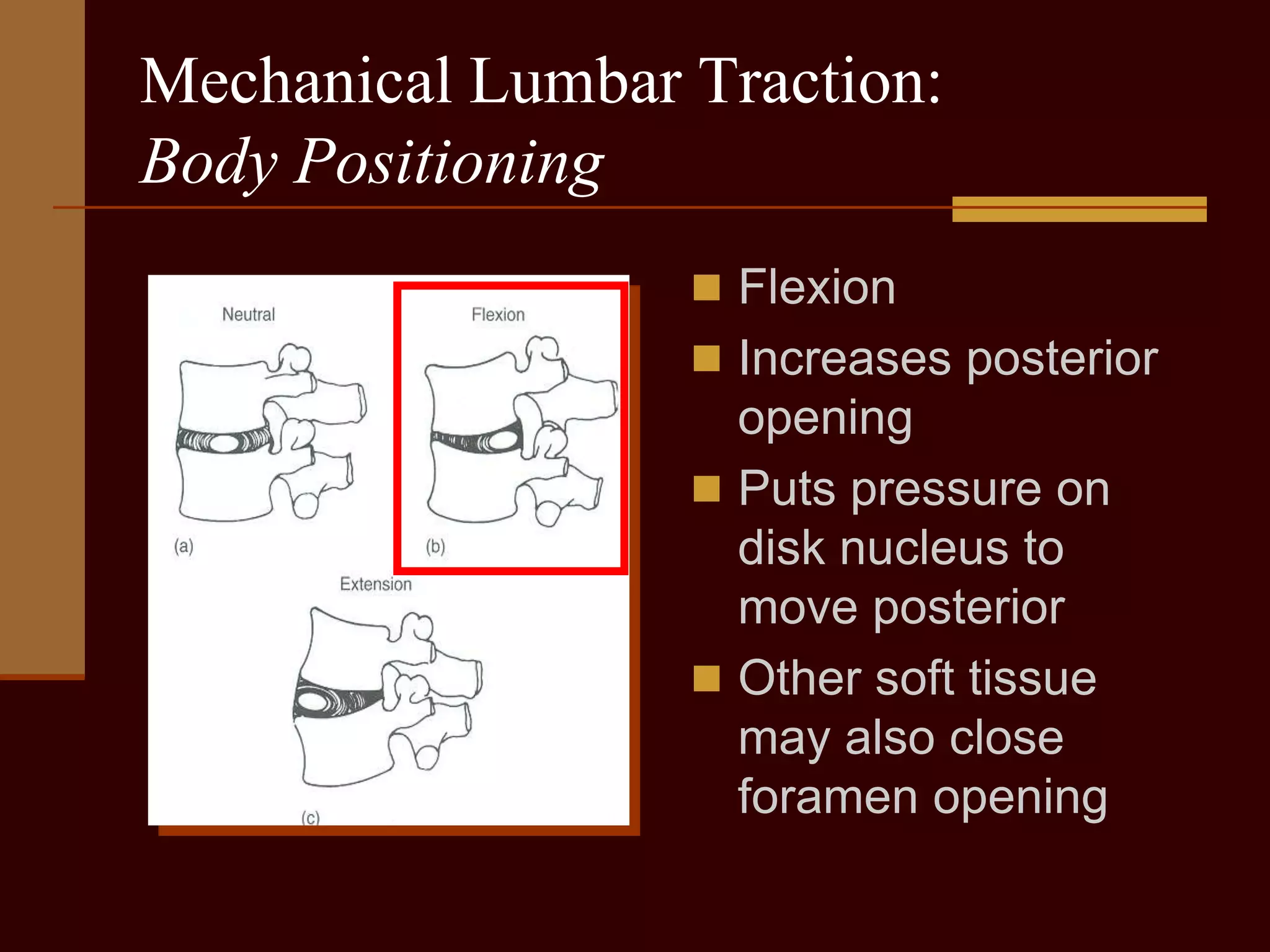 Spinal traction 1 | PPT