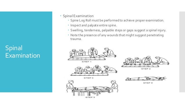 Log Rolling Technique Bed Diagram
