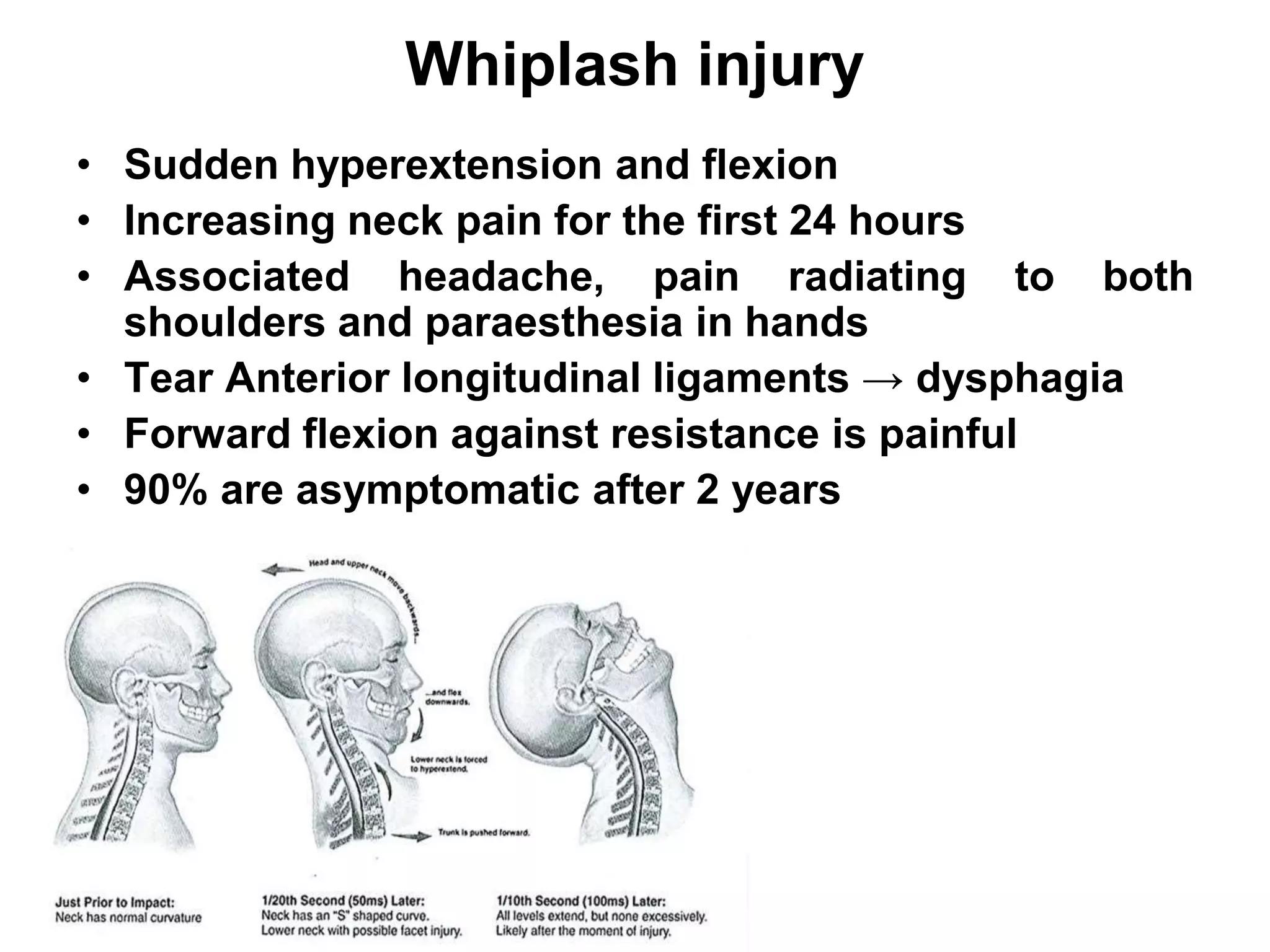 spinal Trauma.ppt